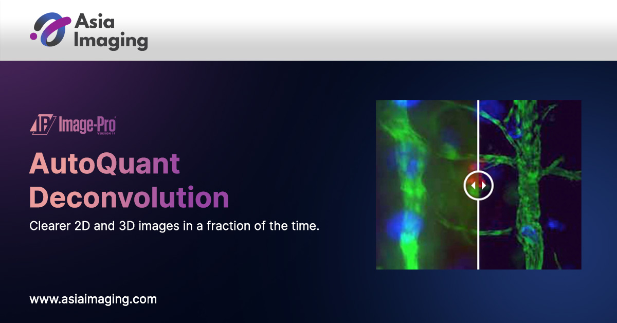 Asia Imaging | AutoQuant Deconvolution | Imaging Solution
